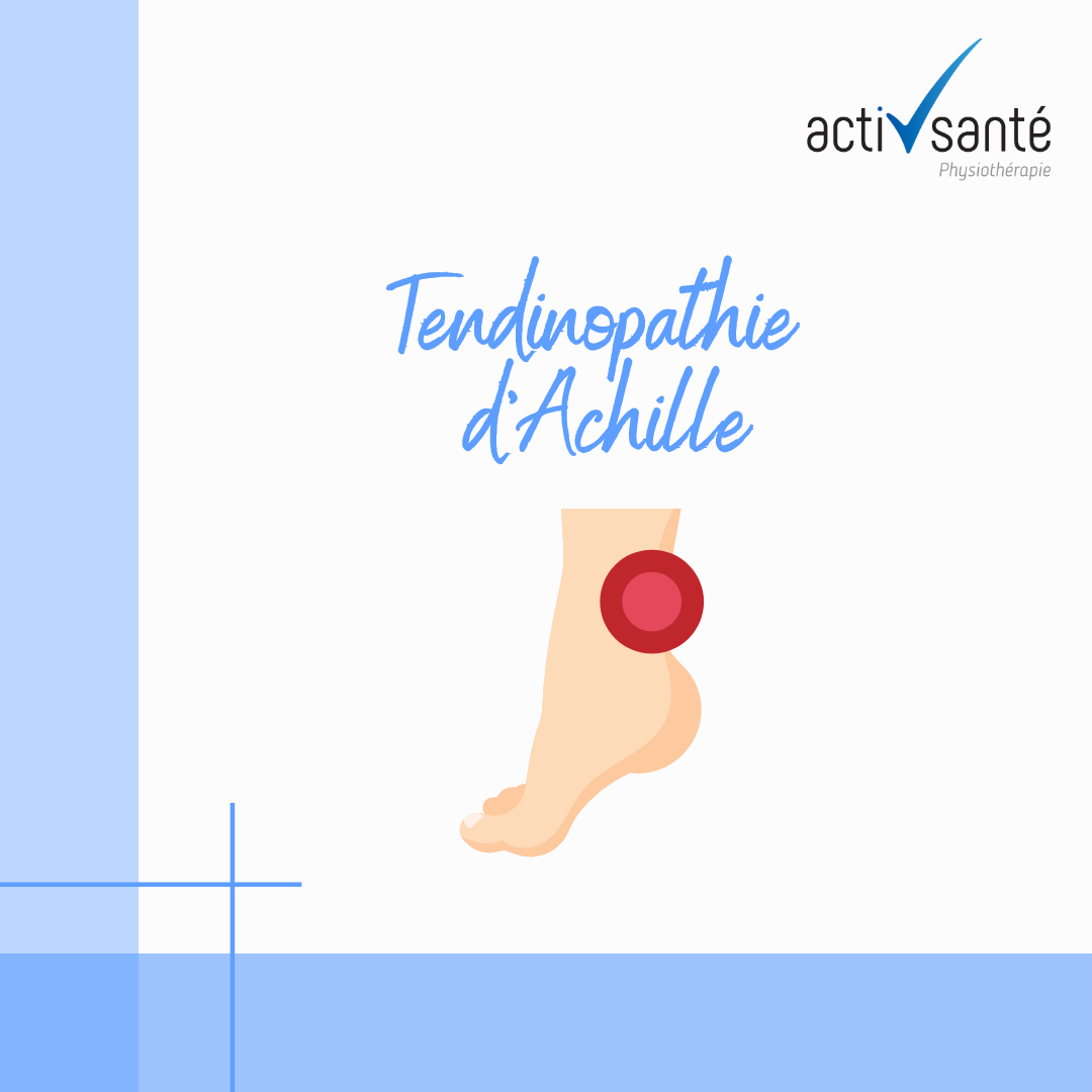 Tendinopathie d’Achille - Activ Santé